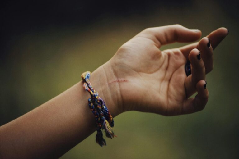 Scar Management After Hand Surgery: Tips for Faster Healing ...